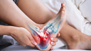 How To Tell If Your Foot Is Fractured | Aether Health