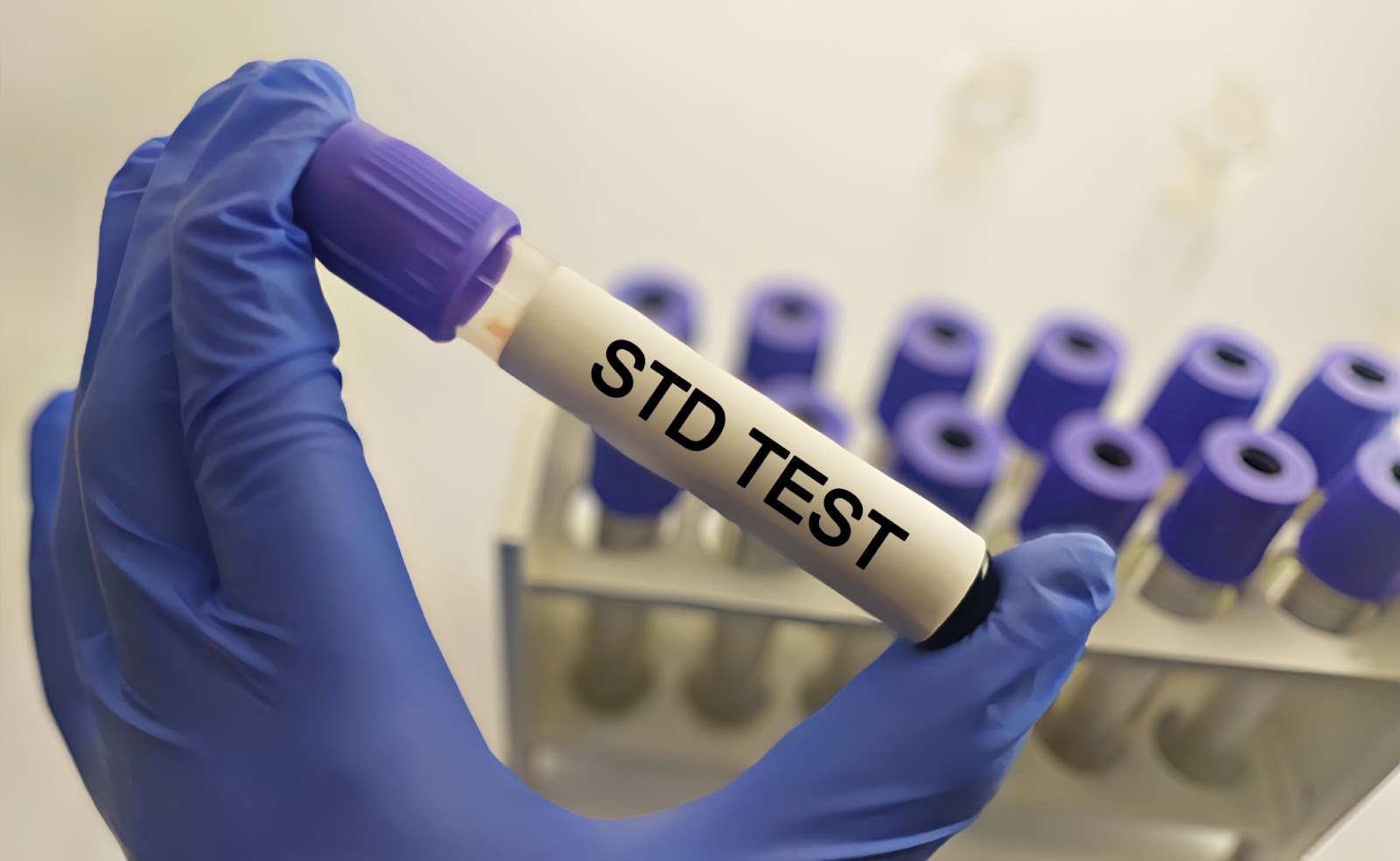 STD Testing Houston, TX | Aether Health
